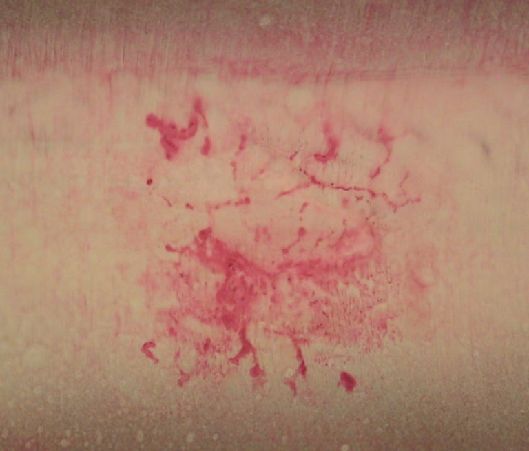 Techniques - FlawTech